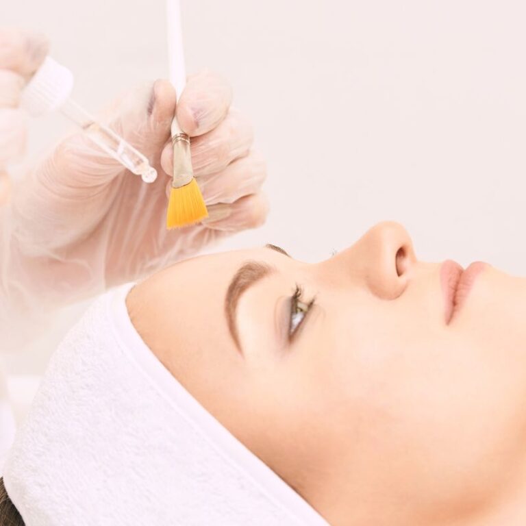 Peeling químico: o que é, cuidados e 5 benefícios